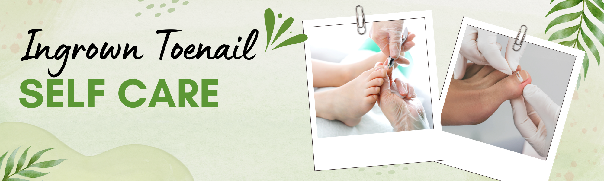 Ingrown Toenail Self Care – La faby
