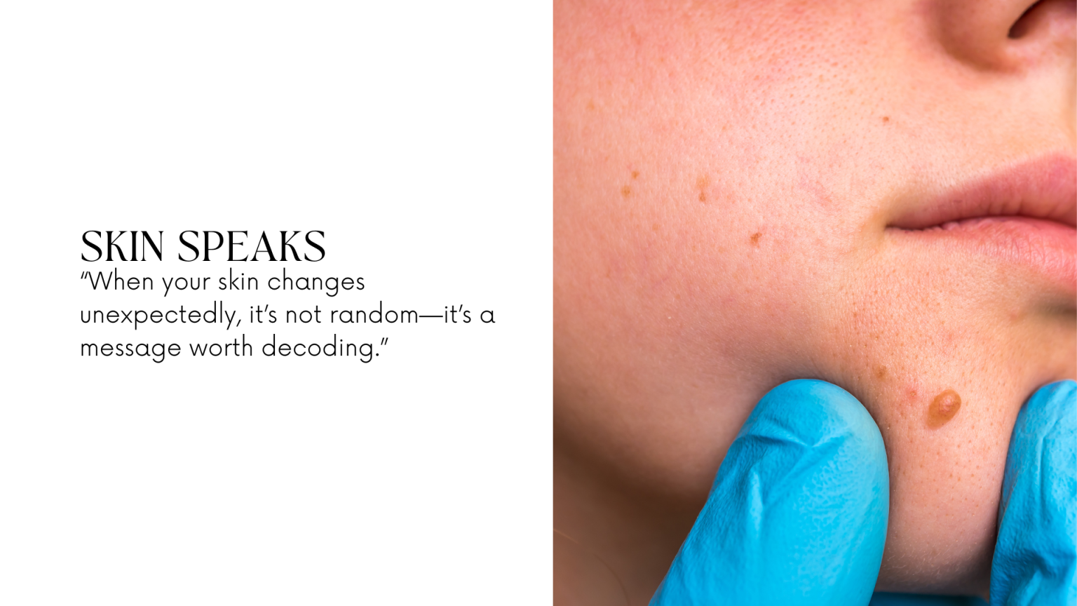 Why Am I Getting Skin Tags All of a Sudden? Causes, Remedies & Skincare ...